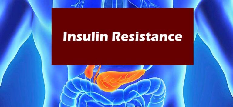 Insulin Resistance - Healthcare